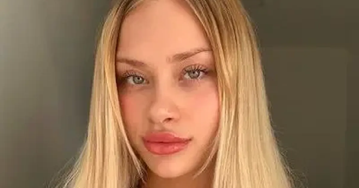 Покалеченная в Дубае украинская модель Мария Ковальчук пришла в ...