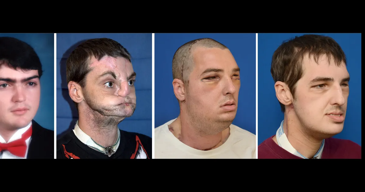 VIDEO Naine kohtab meest, kellele siirati tema surnud venna nägu