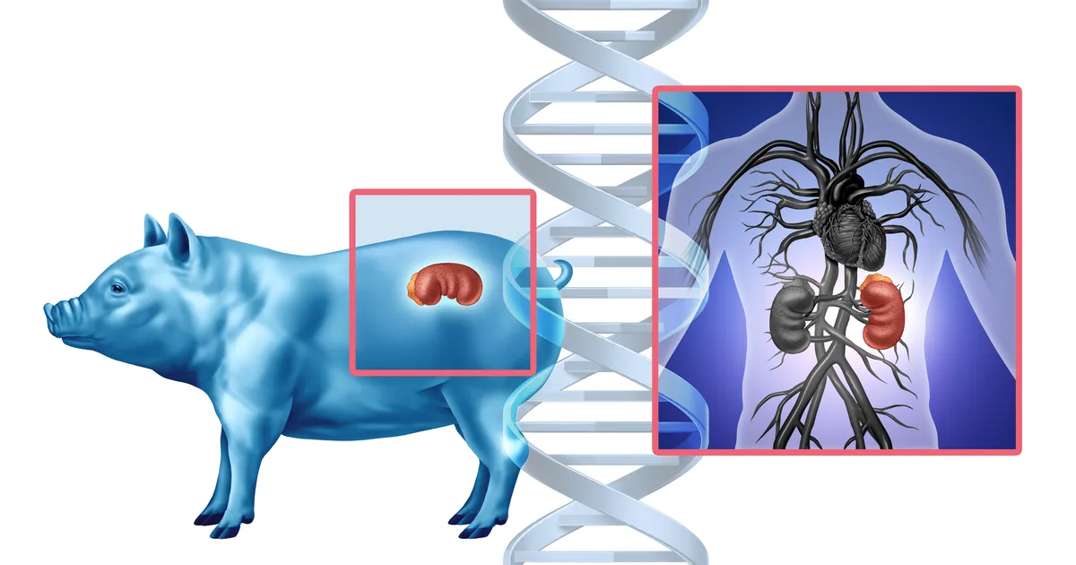 Geneetiliselt muundatud sea neerud inimkehasse? FDA luba antud